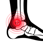 Physical Therapy For Degenerative Disc Disease In NJ | Next Level Physio